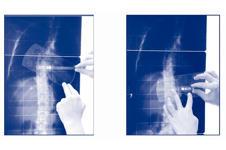 INCLINOMETER HANDBOOK